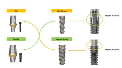 Transfer Abutment - Bursa İmplant İstek Dental