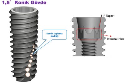 TSIII Osstem İmplant Sistemi Nedir - İstek Dental Bursa